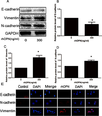 Osteopontin Promotes Invasion, Migration and Epithelial-Mesenchymal ...