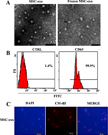 Mesenchymal Stem Cell-Derived Exosomes Improve the Microenvironment of ...