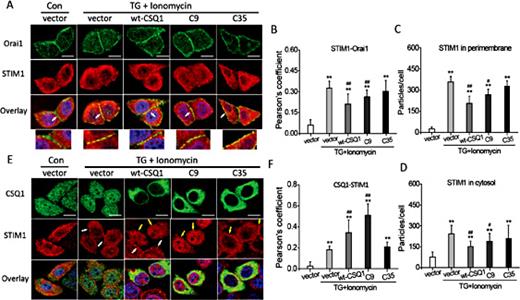 Calsequestrin-1 Regulates Store-Operated Ca2+ Entry by Inhibiting STIM1 ...