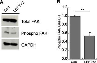 LEFTY2 Controls Migration of Human Endometrial Cancer Cells via Focal ...