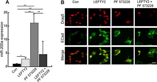 LEFTY2 Controls Migration of Human Endometrial Cancer Cells via Focal ...