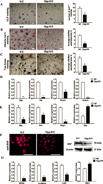 Role of Osteoprotegerin (OPG) in Bone Marrow Adipogenesis | Cellular ...