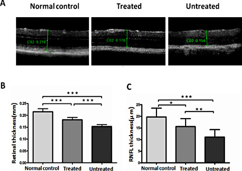 The Vigabatrin Induced Retinal Toxicity is Associated with Photopic ...