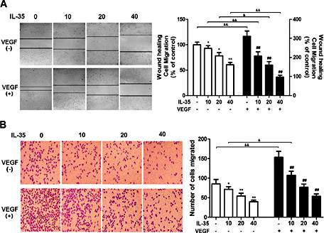 IL-35 Inhibits Angiogenesis through VEGF/Ang2/Tie2 Pathway in ...