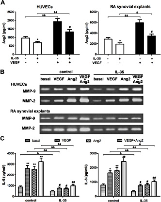 IL-35 Inhibits Angiogenesis through VEGF/Ang2/Tie2 Pathway in Rheumatoid Arthritis | Cellular ...