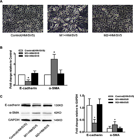 The Role of TLR4 in M1 Macrophage-Induced Epithelial-Mesenchymal ...