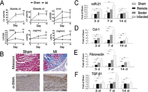 Mir-21 Promotes Cardiac Fibrosis After Myocardial Infarction Via ...