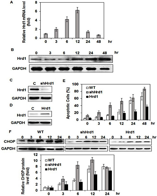 Endoplasmic Reticulum Stress Induces HRD1 to Protect Alveolar Type II ...