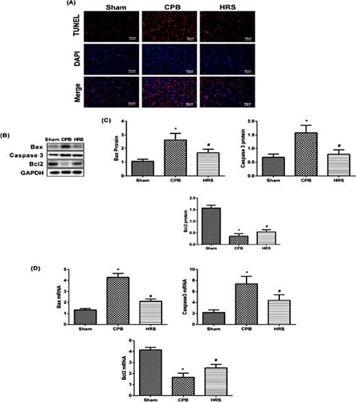 Hydrogen-Rich Saline Attenuates Brain Injury Induced by Cardiopulmonary ...