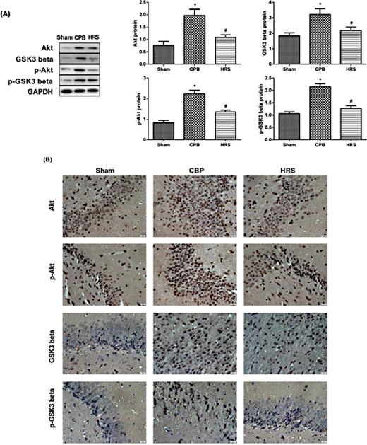 Hydrogen-Rich Saline Attenuates Brain Injury Induced by Cardiopulmonary ...