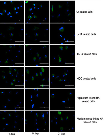 Hybrid Complexes of High and Low Molecular Weight Hyaluronans Highly ...