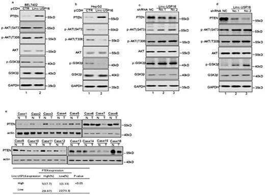 Long Non-Coding RNA Linc-USP16 Functions As a Tumour Suppressor in ...