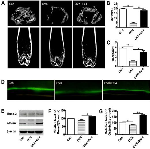 Exendin-4 Induces Bone Marrow Stromal Cells Migration Through Bone ...