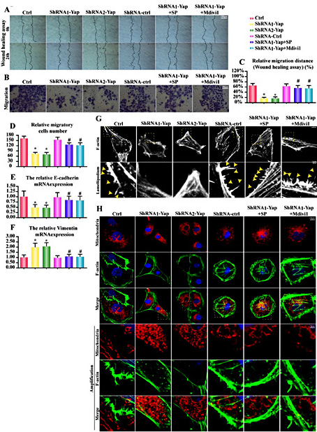 YAP Inhibits the Apoptosis and Migration of Human Rectal Cancer Cells ...