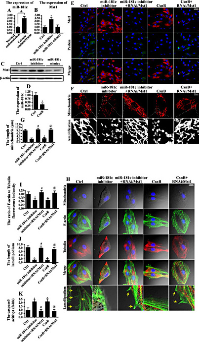 Effect of Mst1 on Endometriosis Apoptosis and Migration: Role of Drp1 ...