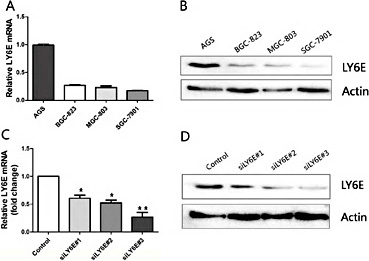 Overexpression of Lymphocyte Antigen 6 Complex, Locus E in Gastric ...