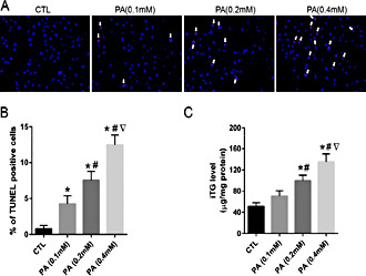 ShenFu Preparation Protects AML12 Cells Against Palmitic Acid-Induced ...