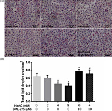 Acetic Acid Influences BRL-3A Cell Lipid Metabolism via the AMPK ...