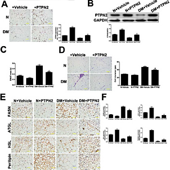 Overexpression of PTPN2 in Visceral Adipose Tissue Ameliorated ...