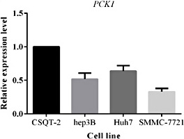 Overexpression of PCK1 Gene Antagonizes Hepatocellular Carcinoma ...