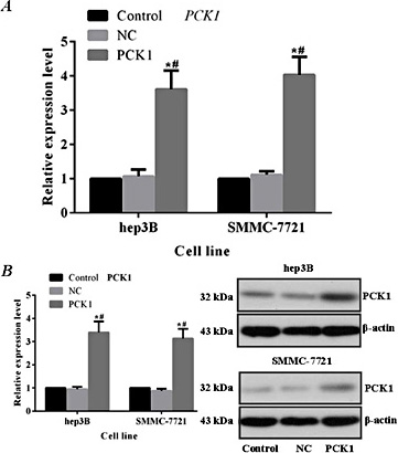 Overexpression of PCK1 Gene Antagonizes Hepatocellular Carcinoma ...