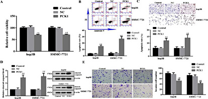 Overexpression of PCK1 Gene Antagonizes Hepatocellular Carcinoma ...