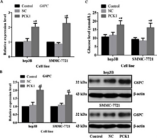 Overexpression of PCK1 Gene Antagonizes Hepatocellular Carcinoma ...