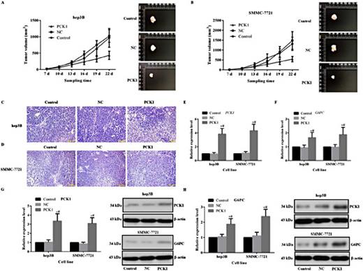 Overexpression of PCK1 Gene Antagonizes Hepatocellular Carcinoma ...