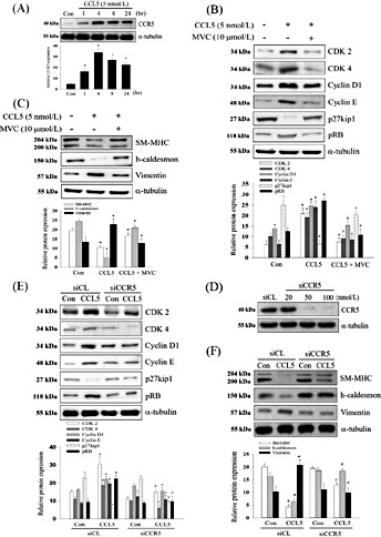The CCL5/CCR5 Axis Promotes Vascular Smooth Muscle Cell Proliferation ...