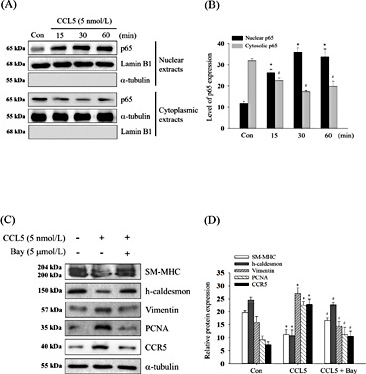 The CCL5/CCR5 Axis Promotes Vascular Smooth Muscle Cell Proliferation ...