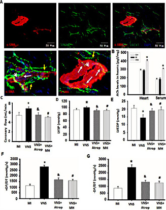 VEGF-A and VEGF-B Coordinate the Arteriogenesis to Repair the Infarcted ...