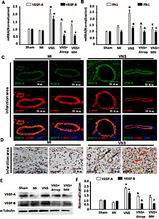VEGF-A and VEGF-B Coordinate the Arteriogenesis to Repair the Infarcted ...