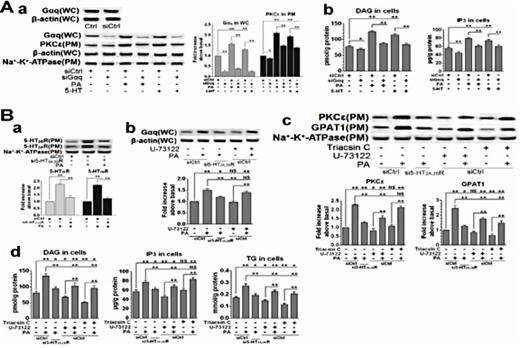 Crucial Roles of 5-HT and 5-HT2 Receptor in Diabetes-Related Lipid ...