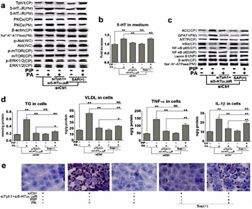 Crucial Roles of 5-HT and 5-HT2 Receptor in Diabetes-Related Lipid ...