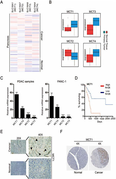 miR-124 Suppresses Pancreatic Ductal Adenocarcinoma Growth by Regulating Monocarboxylate ...