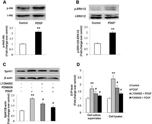 SphK1/S1P Mediates PDGF-Induced Pulmonary Arterial Smooth Muscle Cell ...