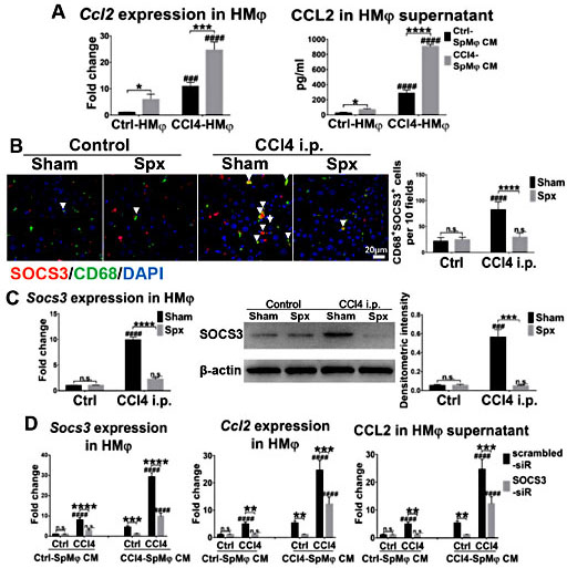 The Spleen Promotes the Secretion of CCL2 and Supports an M1 Dominant ...