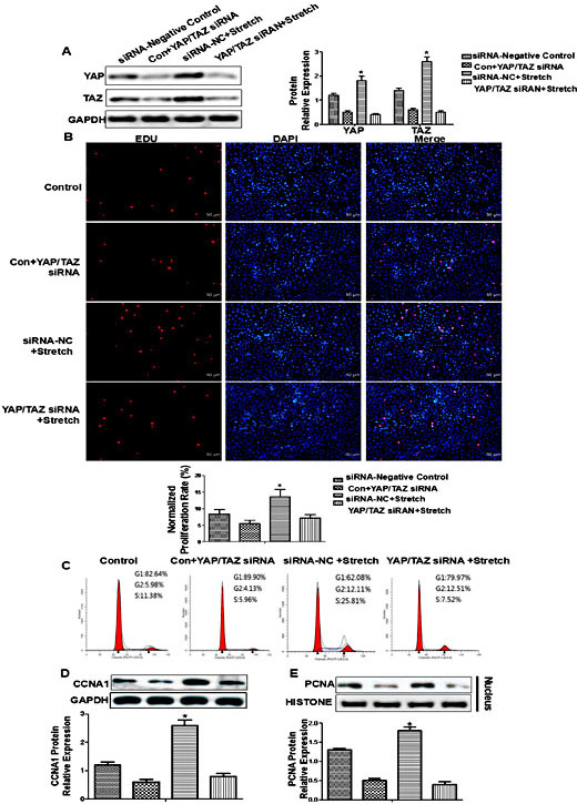 Arterial Wall Stress Induces Phenotypic Switching of Arterial Smooth ...