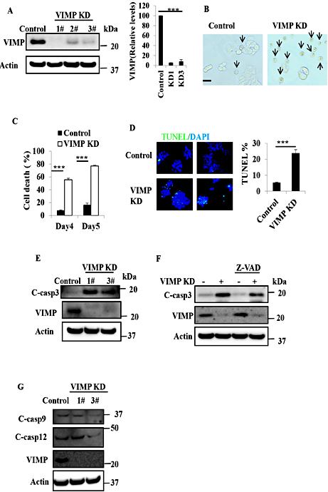 Deficiency of VCP-Interacting Membrane Selenoprotein (VIMP) Leads to G1 ...