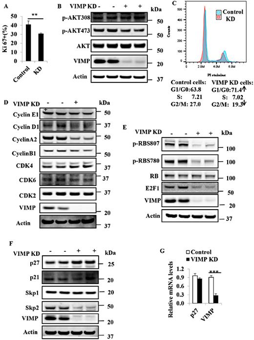 Deficiency of VCP-Interacting Membrane Selenoprotein (VIMP) Leads to G1 ...
