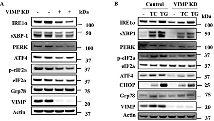 Deficiency of VCP-Interacting Membrane Selenoprotein (VIMP) Leads to G1 ...