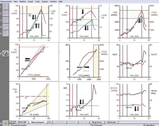 Cardiopulmonary Exercise Testing: The ABC for the Clinical Cardiologist ...