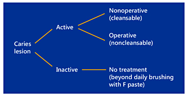 Nyvad Criteria for Caries Lesion Activity and Severity Assessment: A ...