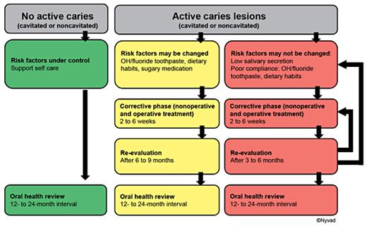 Nyvad Criteria for Caries Lesion Activity and Severity Assessment: A ...