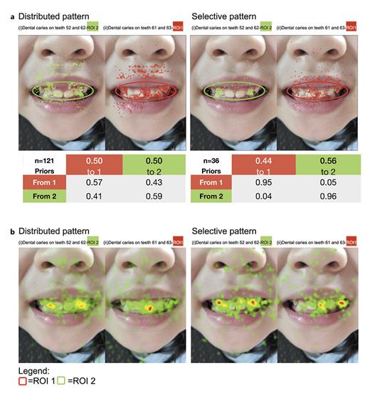 Understanding Children’s Attention to Dental Caries through Eye ...