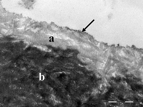 Ultrastructure of the Dentin Pellicle and the Impact of Erosion ...