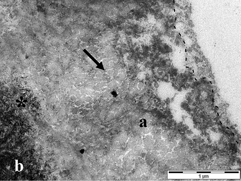 Ultrastructure of the Dentin Pellicle and the Impact of Erosion ...