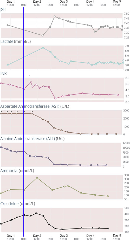Non-Intentional N-Acetylcysteine Overdose Associated with Cerebral ...