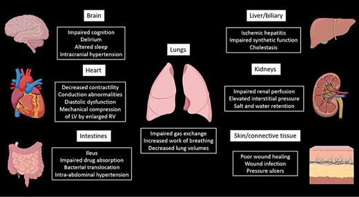 Diagnosis of Fluid Overload: From Conventional to Contemporary Concepts ...