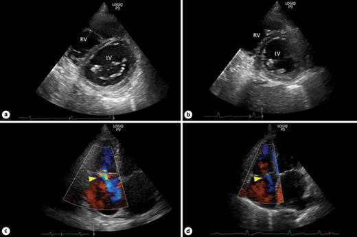 Diagnosis of Fluid Overload: From Conventional to Contemporary Concepts ...
